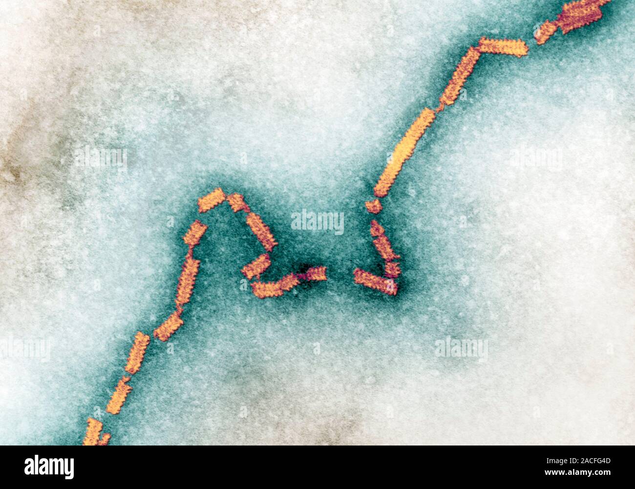 Human parainfluenza virus. Transmission electron micrograph (TEM) of ribonuclear protein helices ...