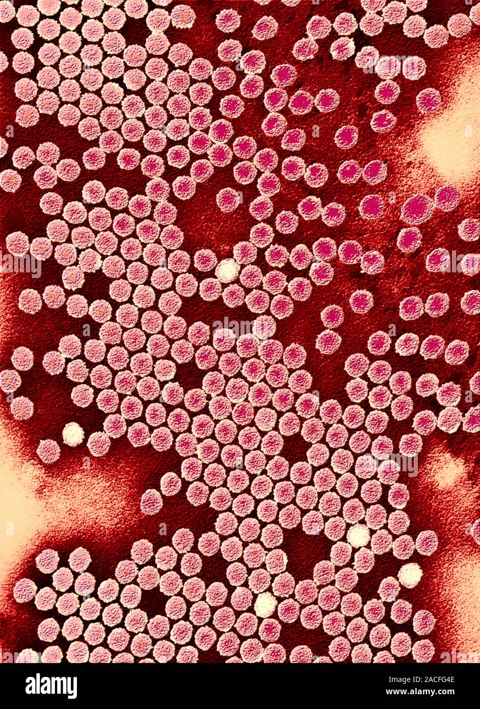 Poliovirus particles. Coloured transmission electron micrograph (TEM ...