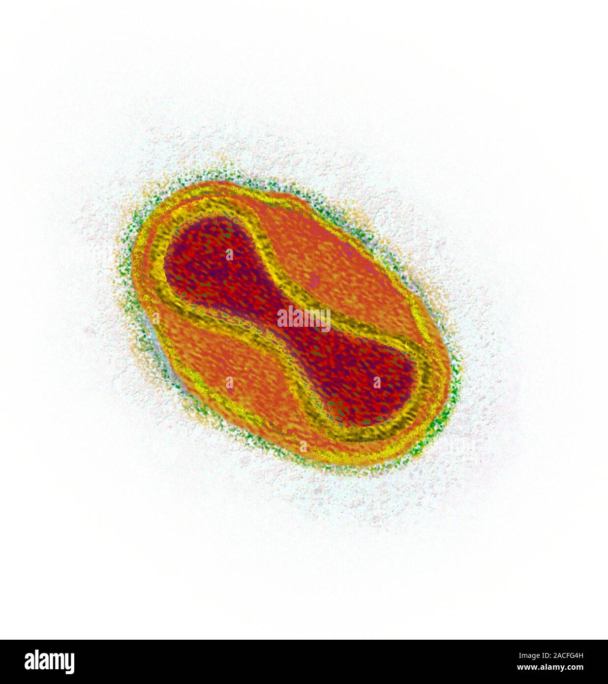 Smallpox virus particle. Coloured transmission electron micrograph (TEM) of a Variola major ...