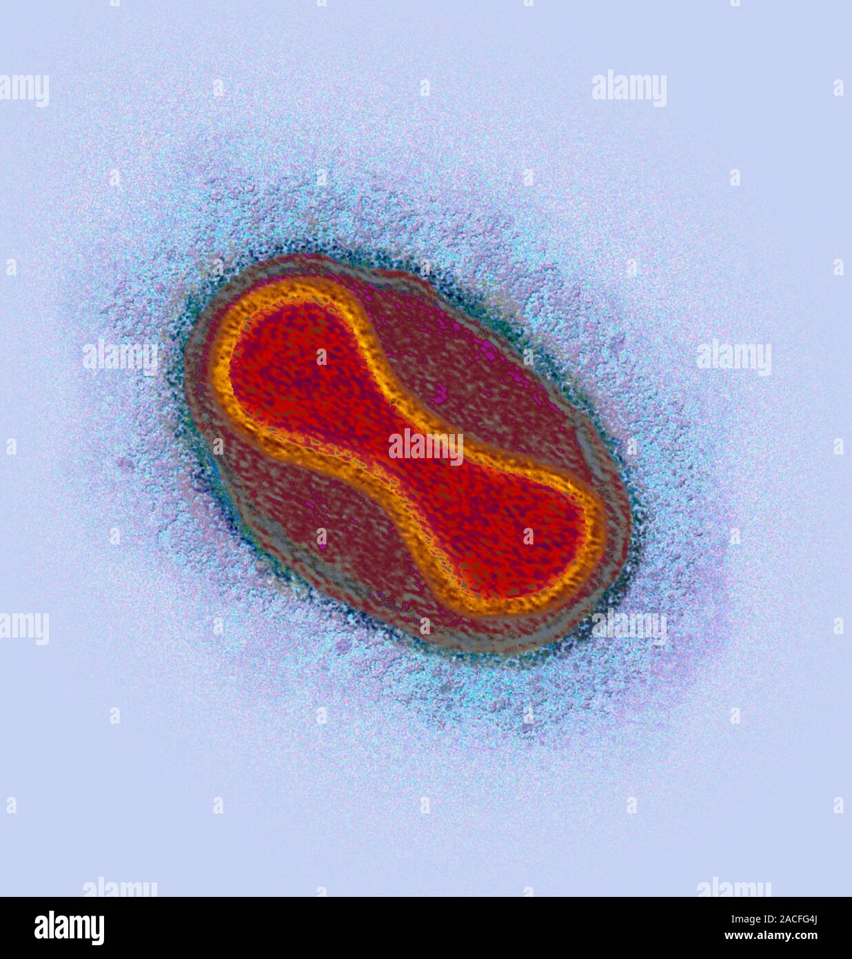 Smallpox virus particle. Coloured transmission electron micrograph (TEM ...