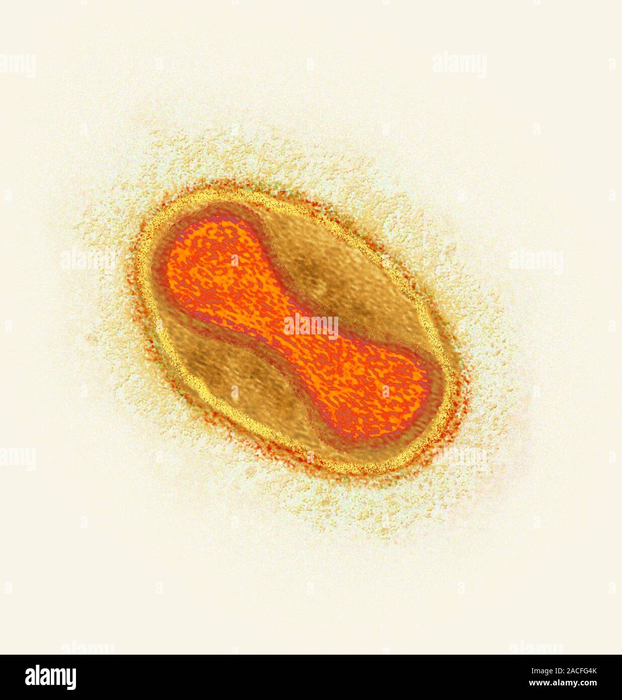Smallpox virus particle. Coloured transmission electron micrograph (TEM) of a Variola major ...