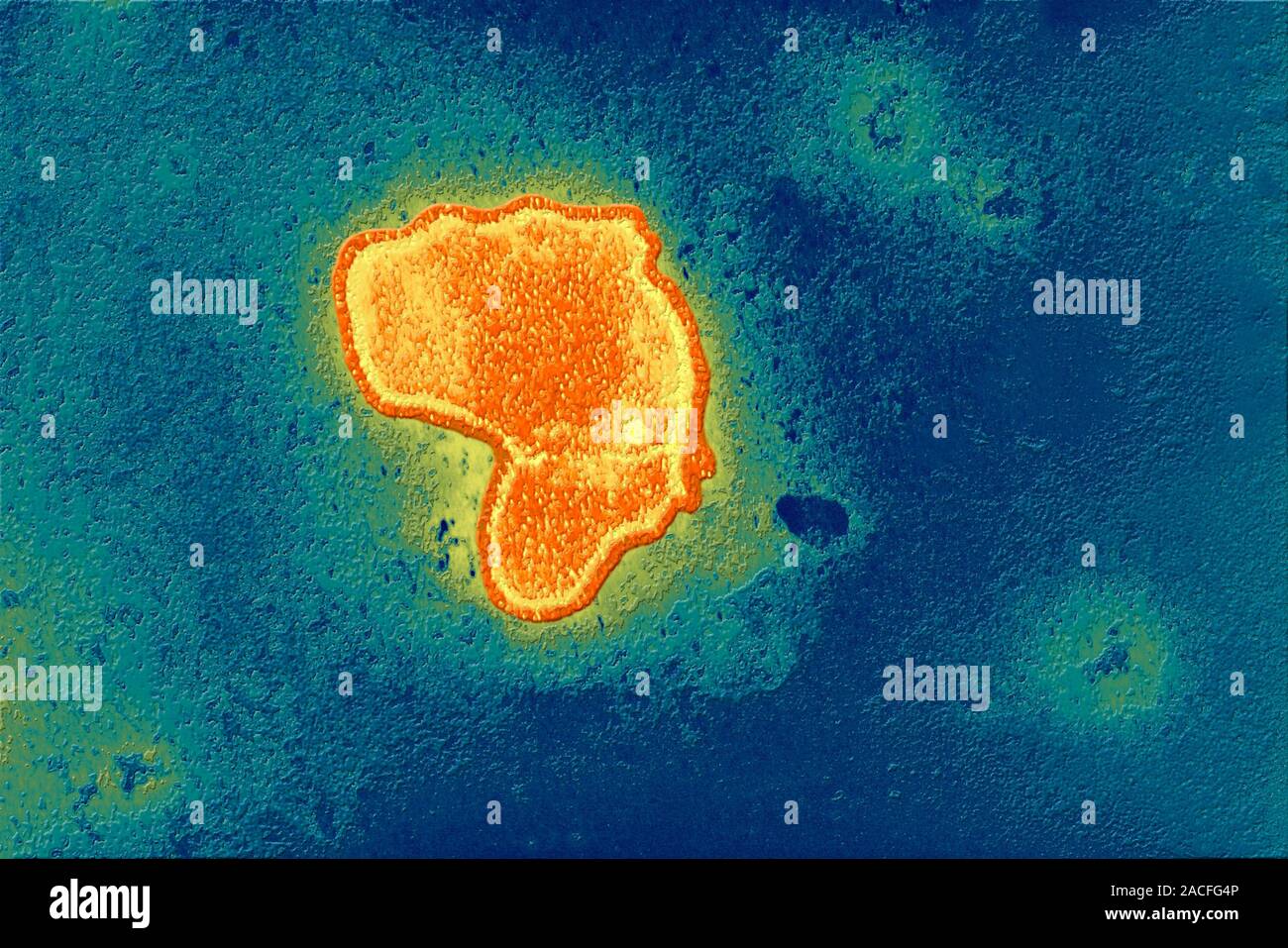 Respiratory syncytial virus (RSV) particle, coloured transmission ...