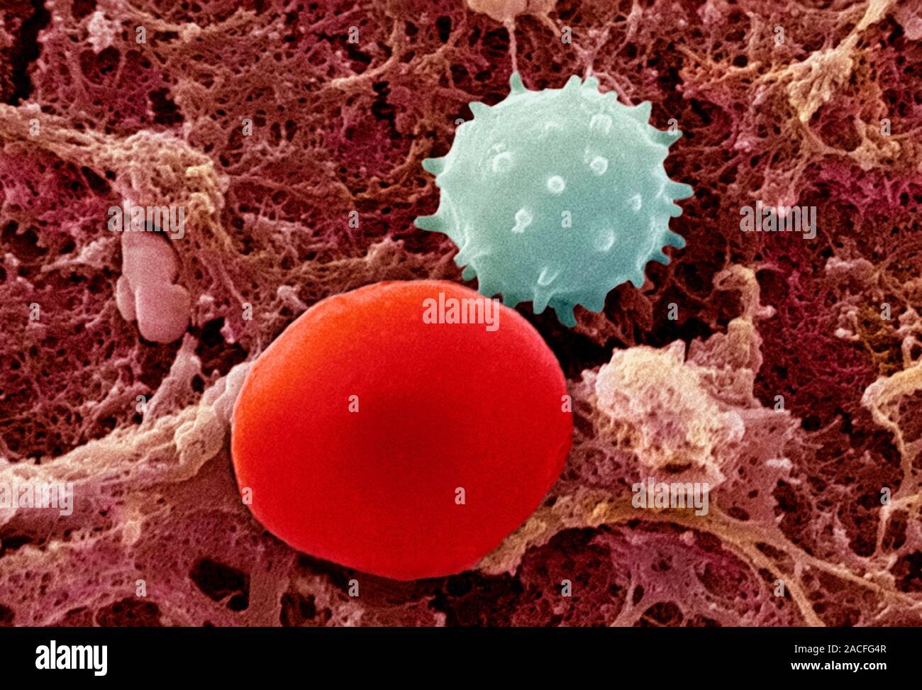 Blood cells. Coloured scanning electron micrograph (SEM) of a human red ...
