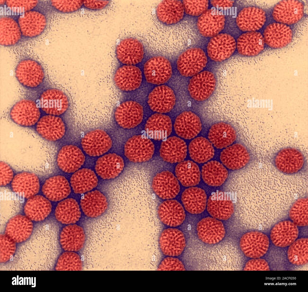 Rotavirus particles. Coloured transmission electron micrograph (TEM) of ...