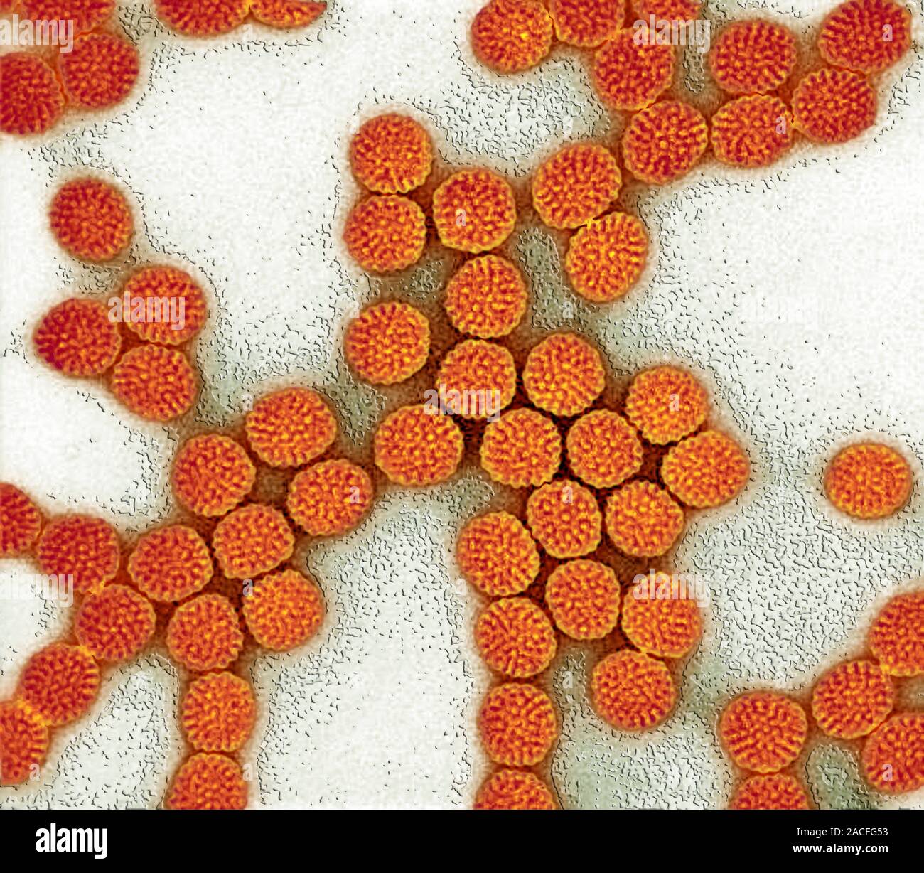 Rotavirus particles. Coloured transmission electron micrograph (TEM) of ...