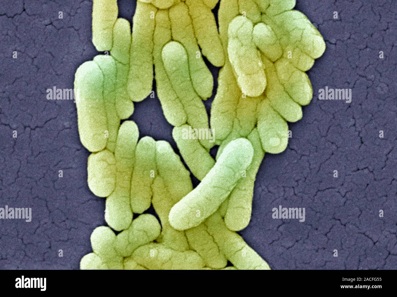 Salmonella typhimurium bacteria, coloured scanning electron micrograph ...