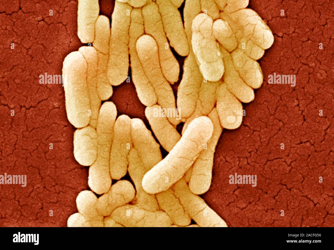 Salmonella typhimurium bacteria, coloured scanning electron micrograph ...