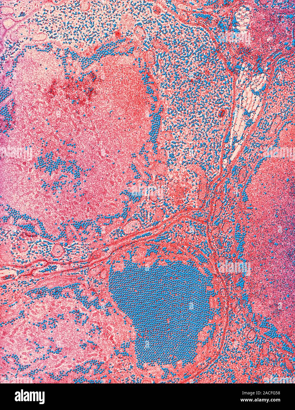 St. Louis encephalitis virus. Coloured transmission electron micrograph ...