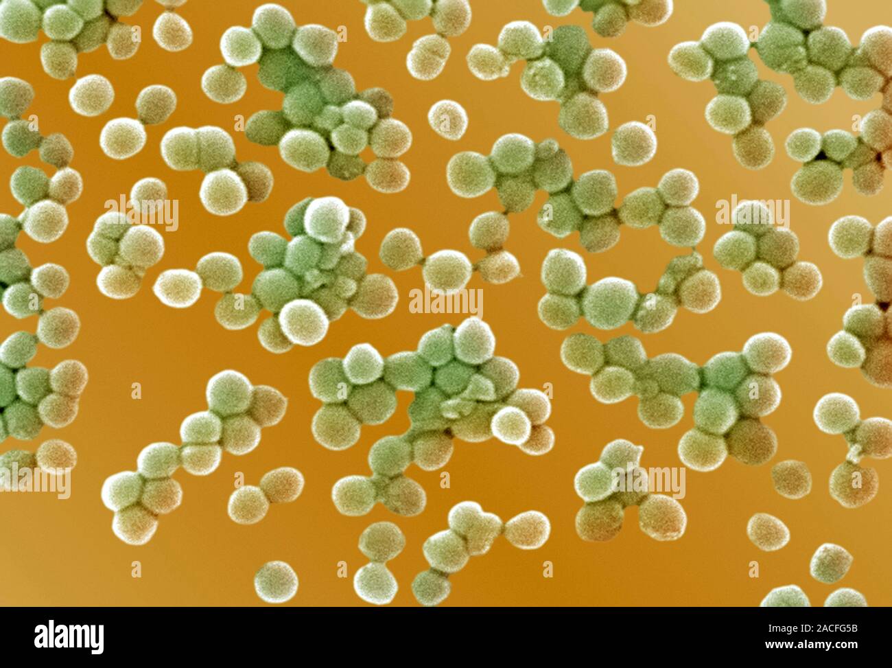MRSA bacteria, coloured scanning electron micrograph (SEM). Methicillin ...