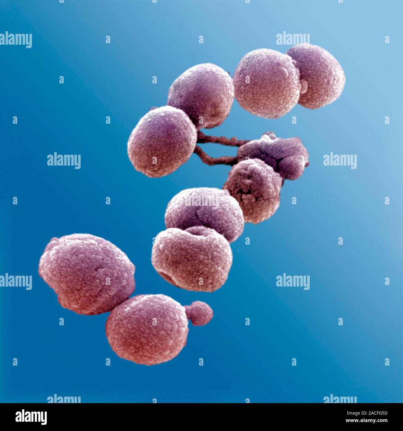 Streptococcus Pneumoniae Electron Micrograph 240 Streptococcus