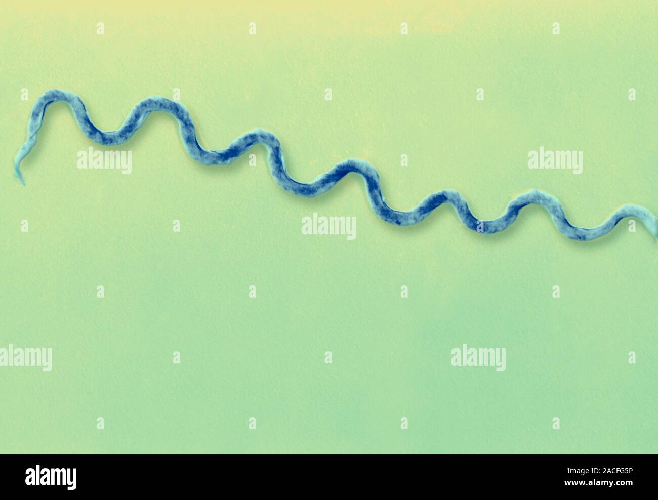 Syphilis bacterium. Coloured transmission electron micrograph (TEM) showing the spirochaete ...