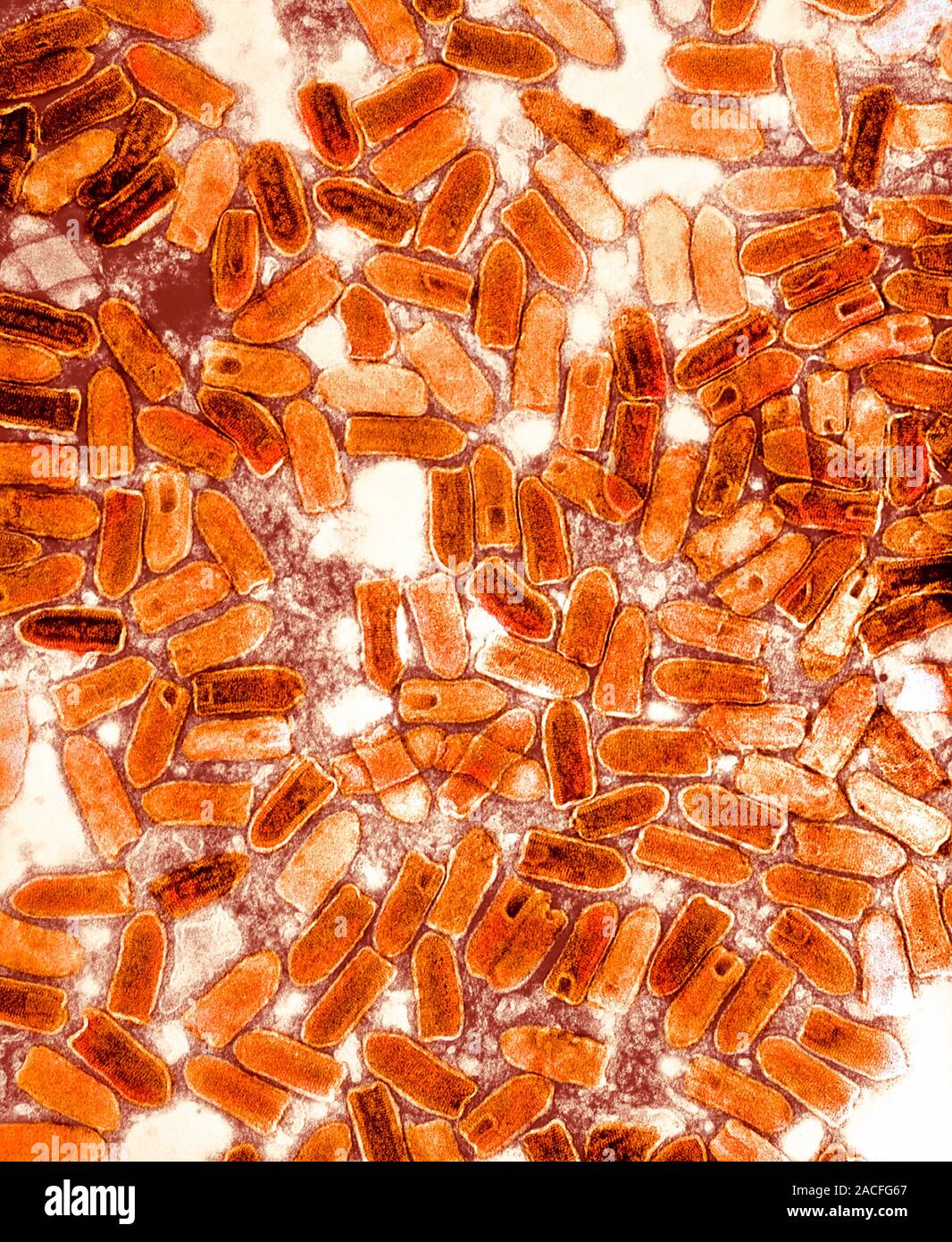 Rhabdovirus. Transmission electron micrograph (TEM) of particles of the ...