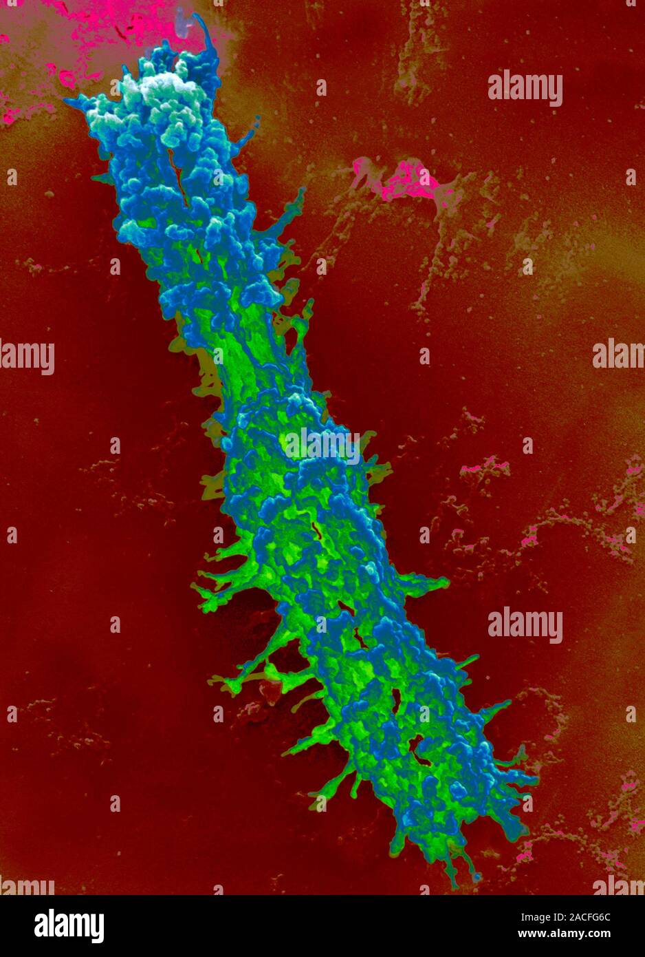 Human chromosome, coloured scanning electron micrograph (SEM ...