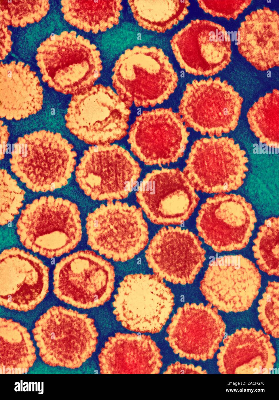 Herpes virus particles, coloured transmission electron micrograph (TEM ...