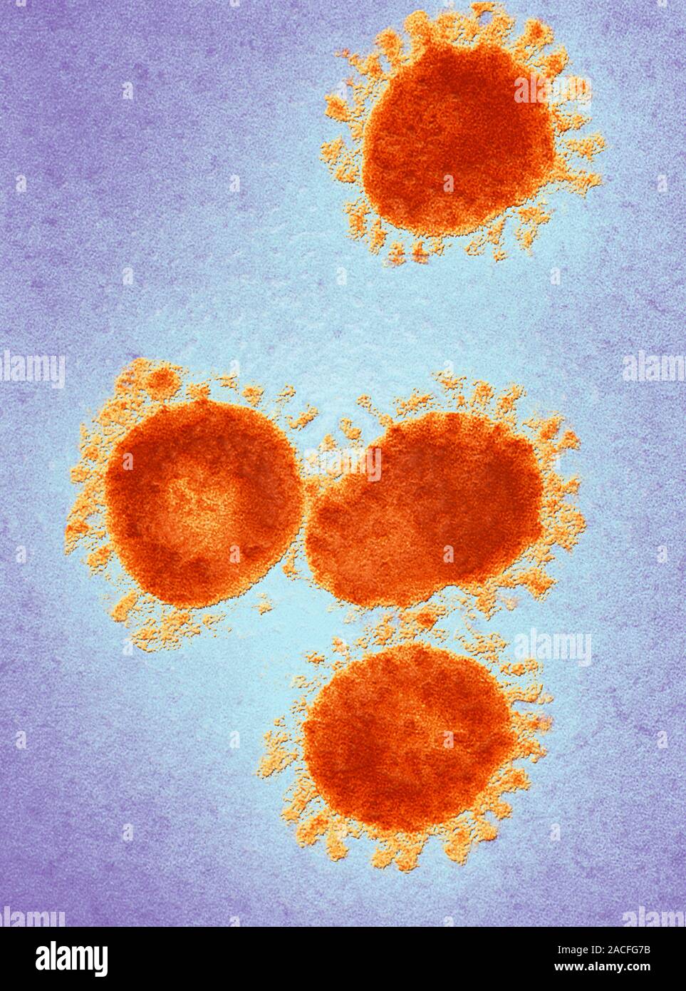 Infectious bronchitis virus (IBV) particles, coloured transmission ...