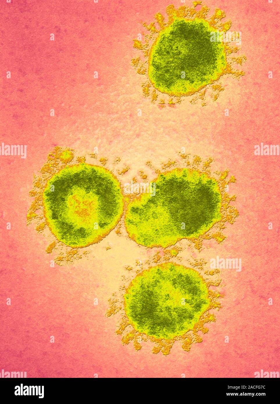 Infectious bronchitis virus (IBV) particles, coloured transmission ...