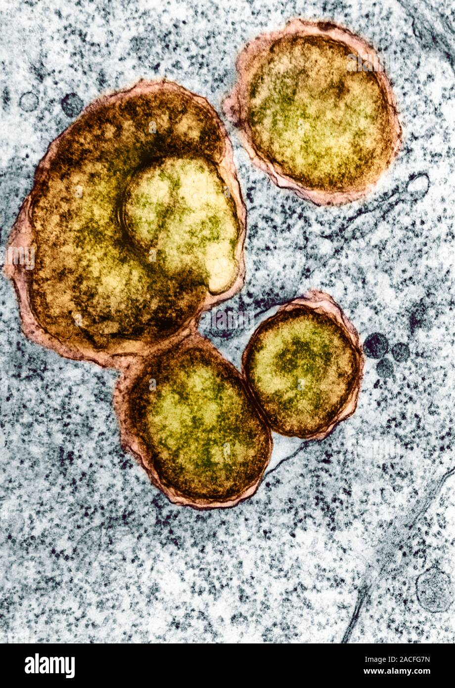 Mosquito ovary infected with bacteria. Coloured transmission electron ...