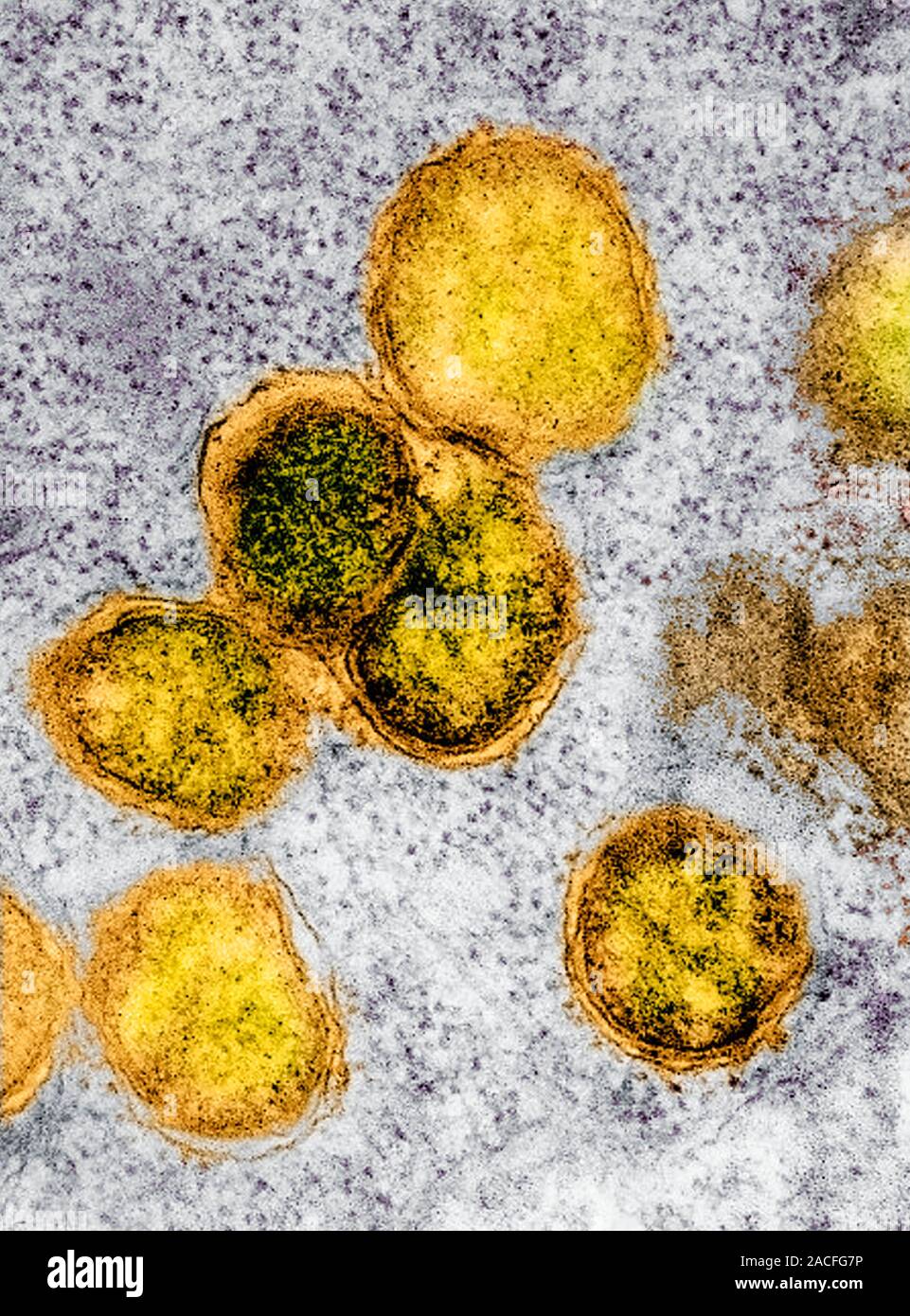Mosquito testis infected with bacteria. Coloured transmission electron ...