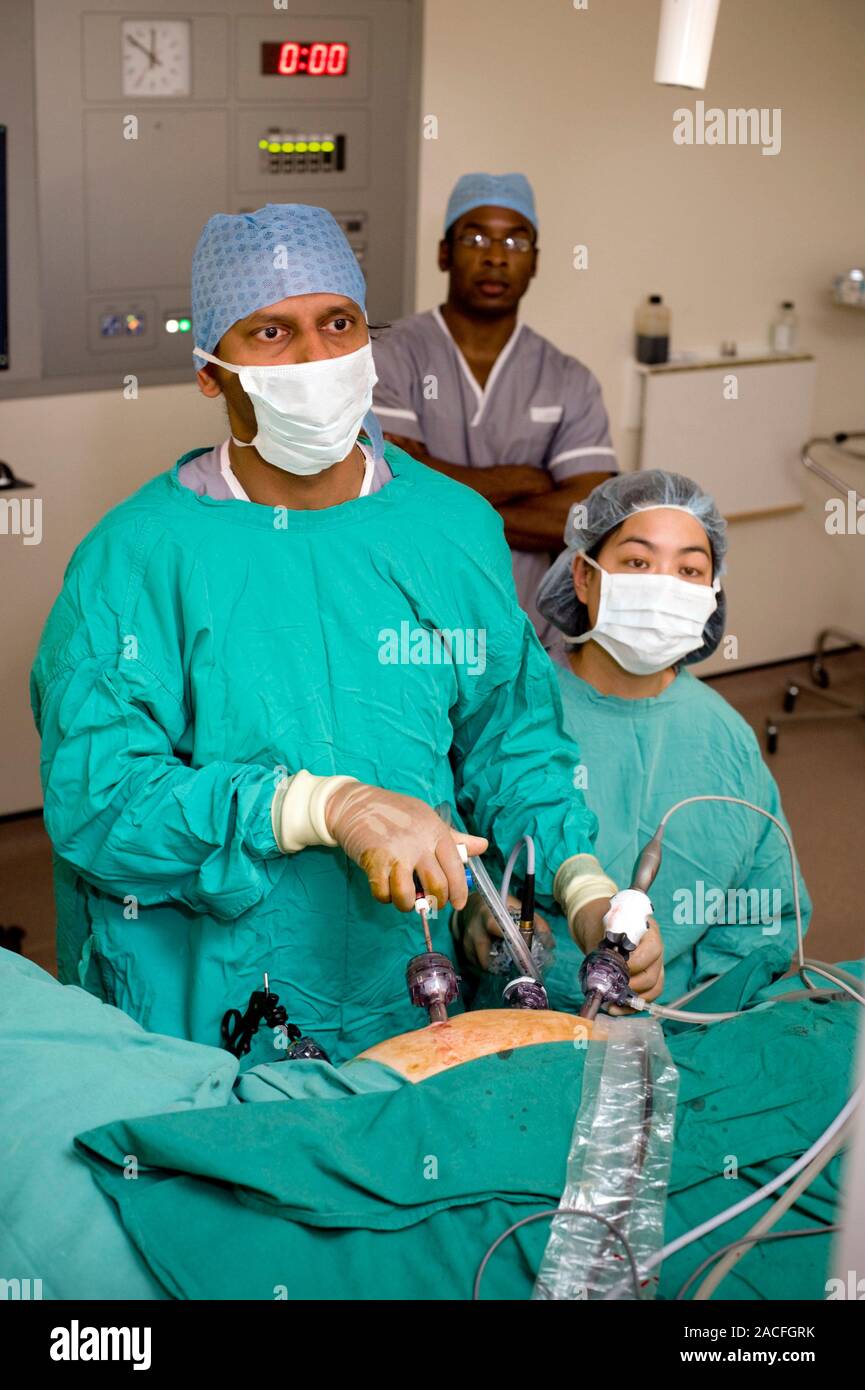 Keyhole surgery. Surgeons using keyhole (laparascopic) surgery to ...