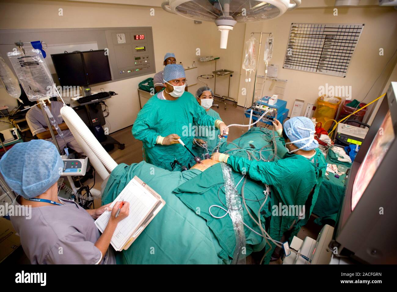 Keyhole surgery. Surgeons using keyhole (laparascopic) surgery to ...