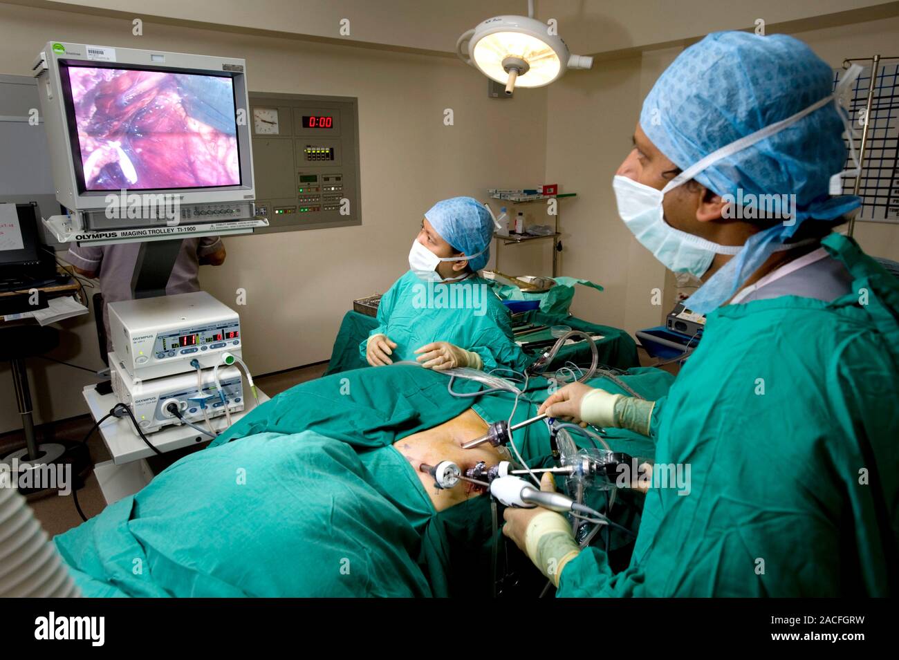 Keyhole surgery. Surgeons using keyhole (laparascopic) surgery to ...