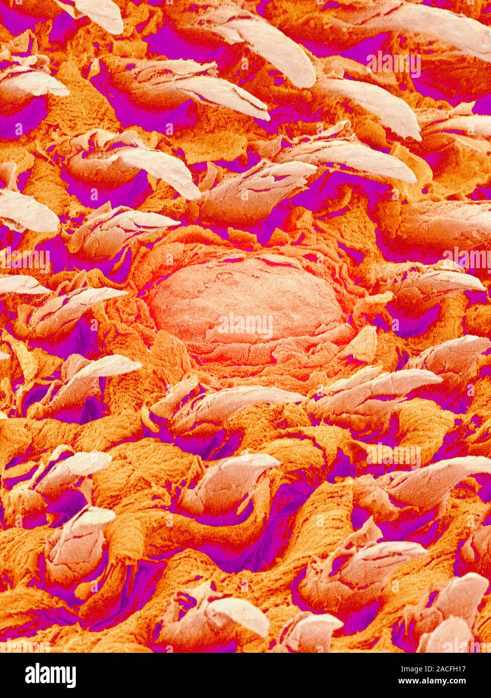 Tongue surface, coloured scanning electron micrograph (SEM). Covering ...