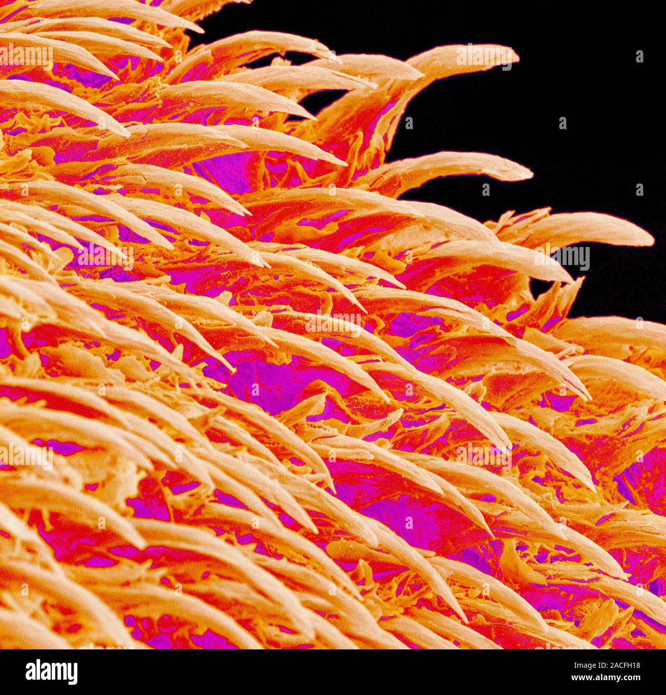 Tongue surface, coloured scanning electron micrograph (SEM). The tongue ...