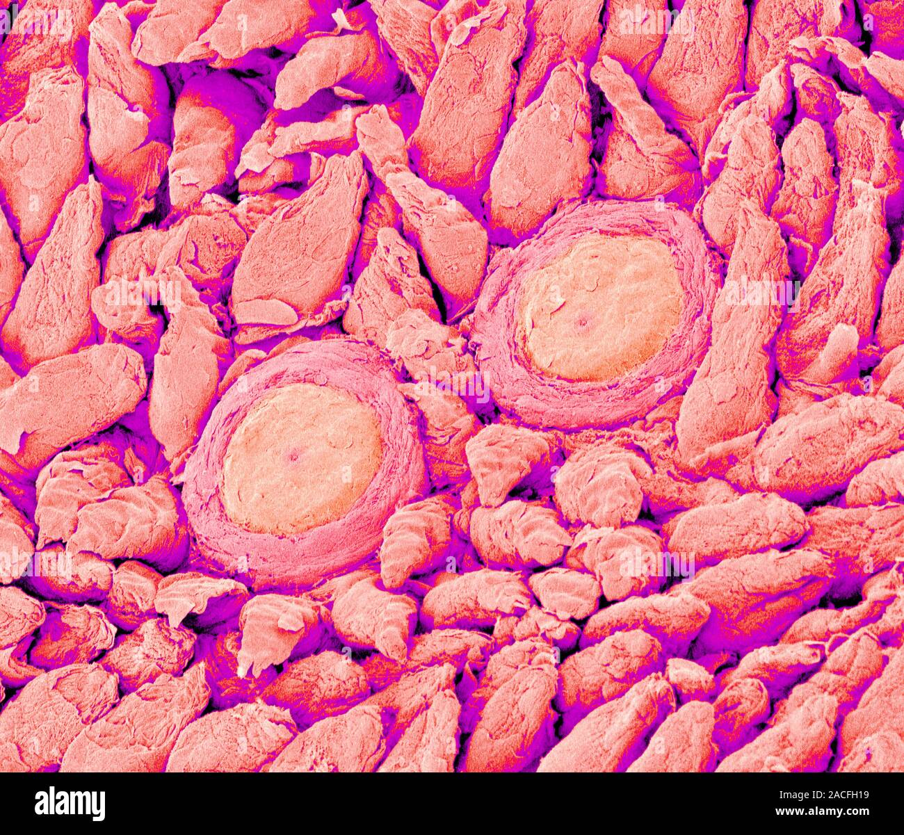 Tongue surface, coloured scanning electron micrograph (SEM). Covering ...