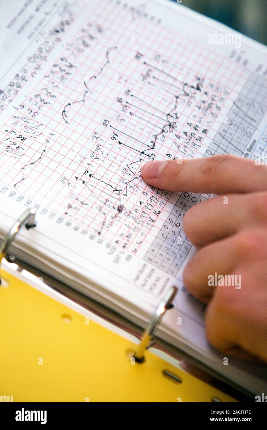 Checking patient notes. This chart shows the changes in the patient's ...