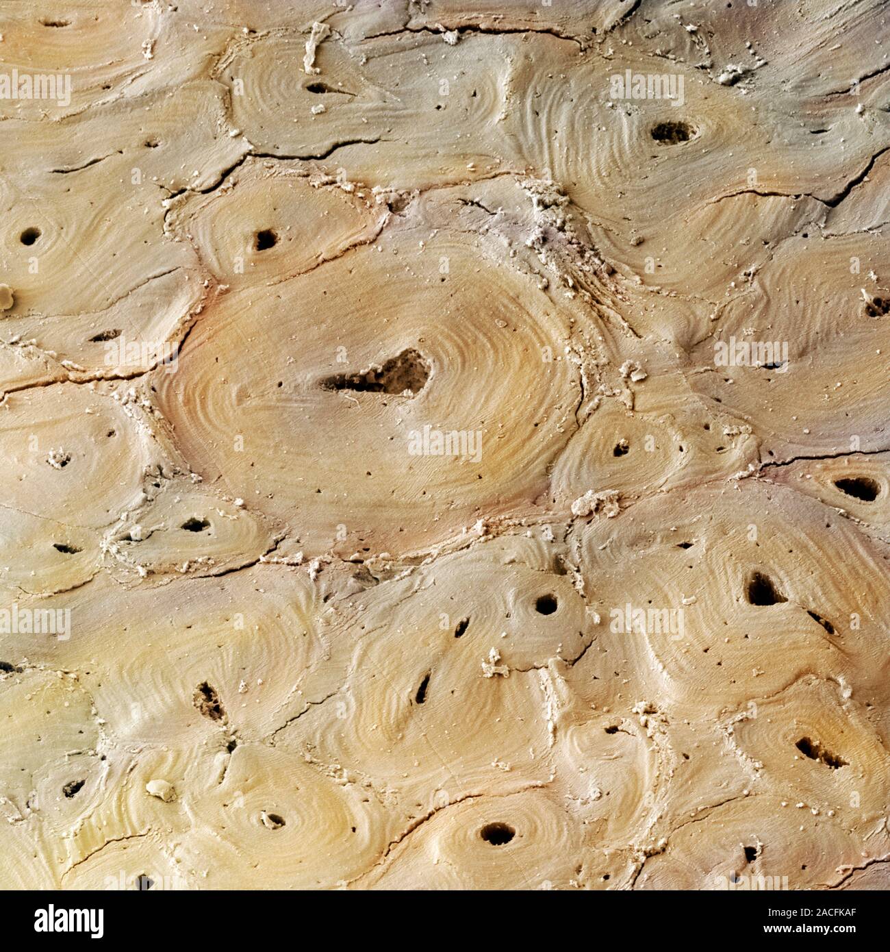 Deer antler. Coloured scanning electron micrograph (SEM) of a ...