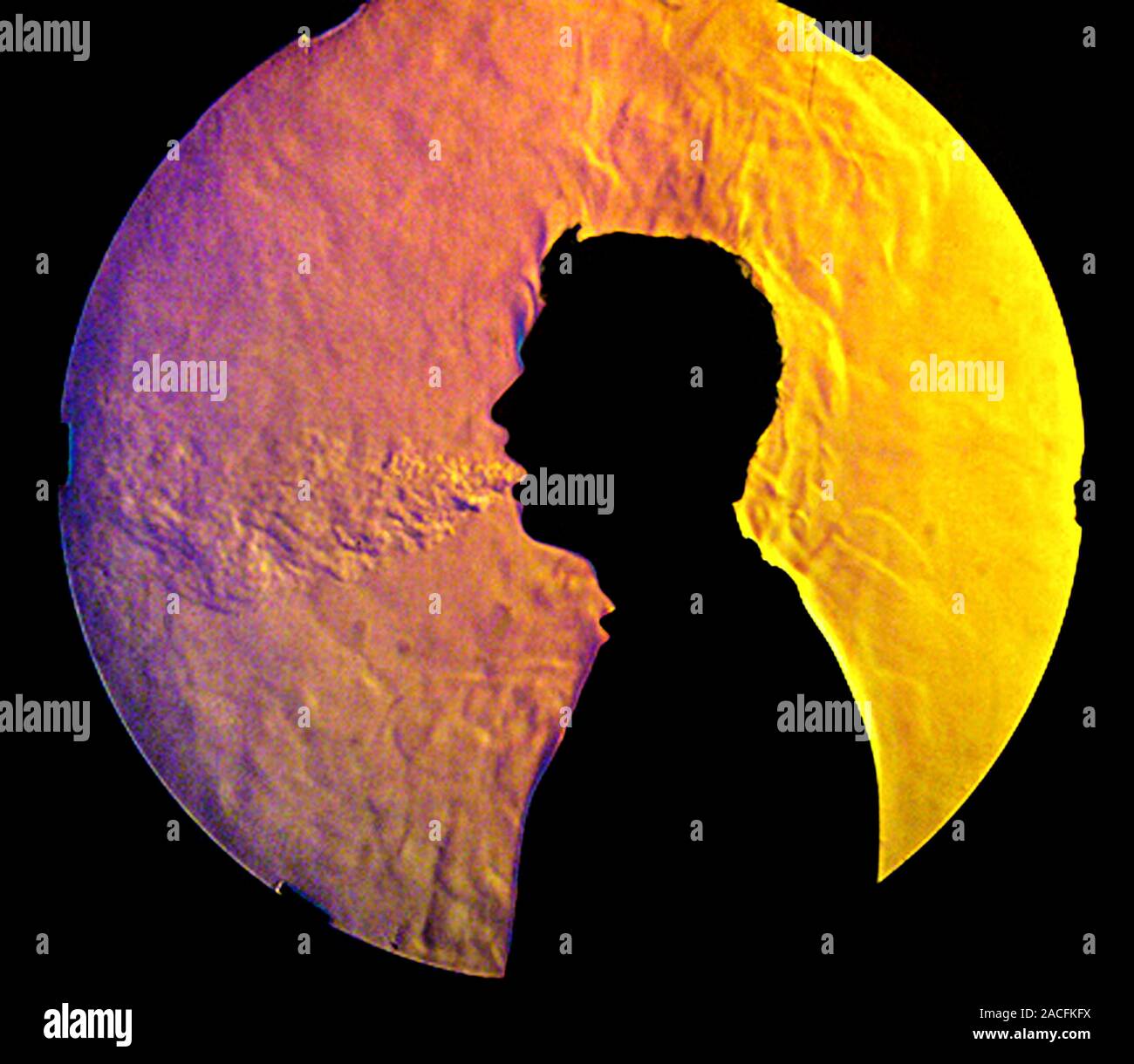 Human thermal plume, schlieren image. Schlieren photography is an ...