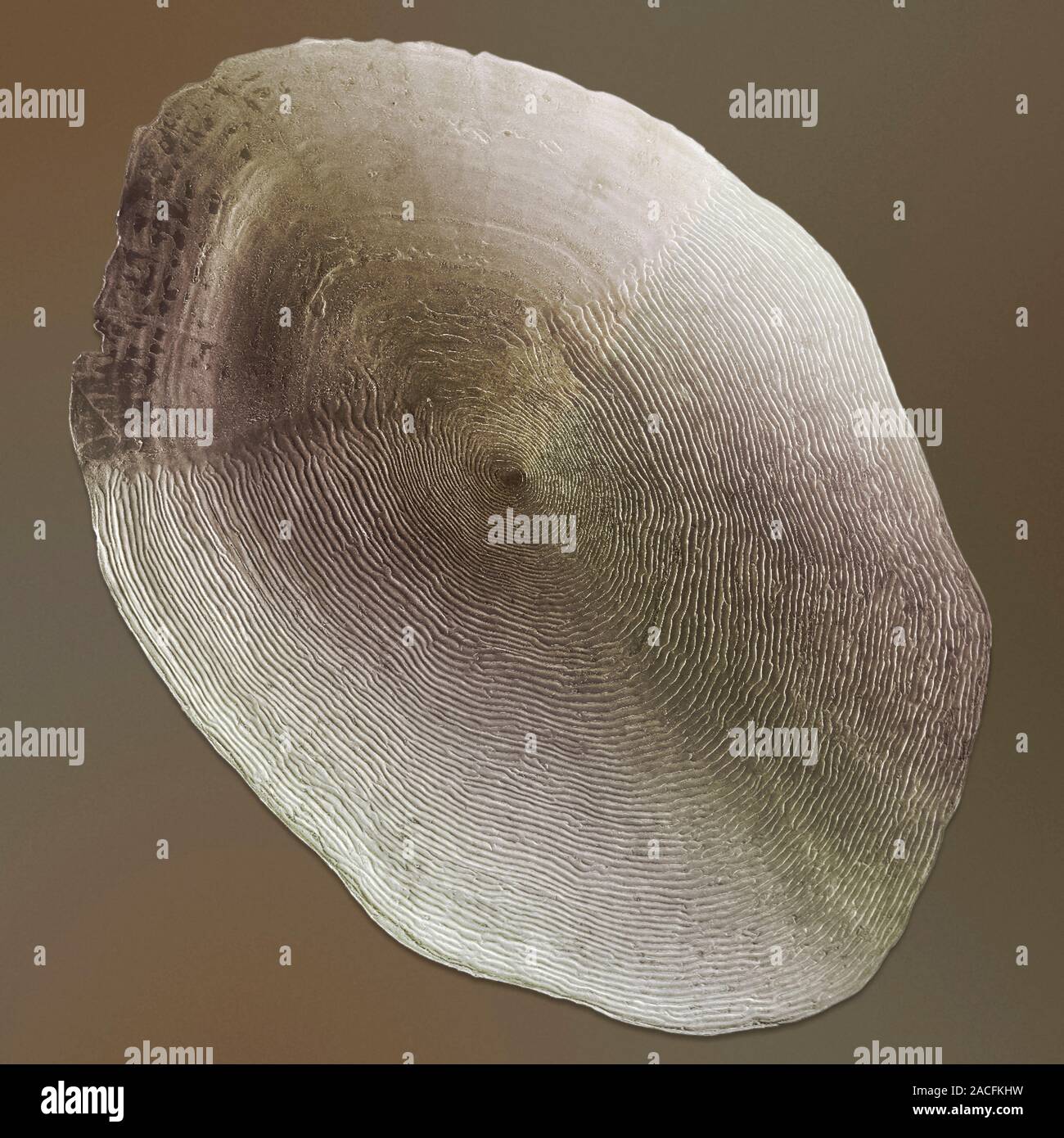 Salmon scale. Coloured scanning electron micrograph (SEM) of a salmon ...