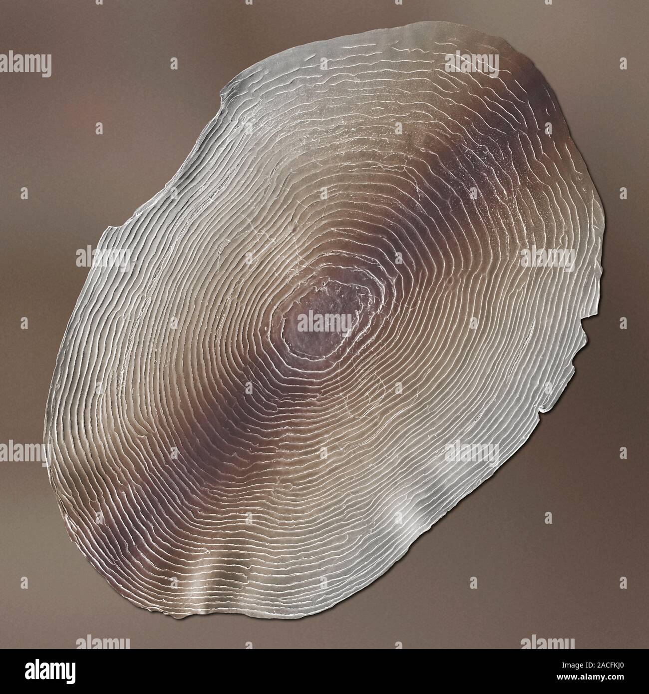 Rainbow trout scale. Coloured scanning electron micrograph (SEM) of a ...