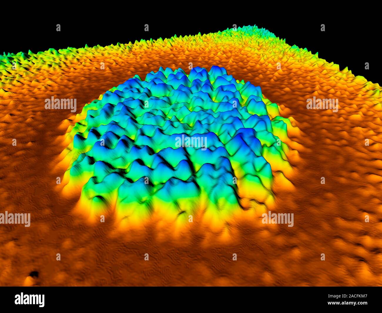 Herpes virus particle, 3D coloured scanning electron micrograph (SEM ...
