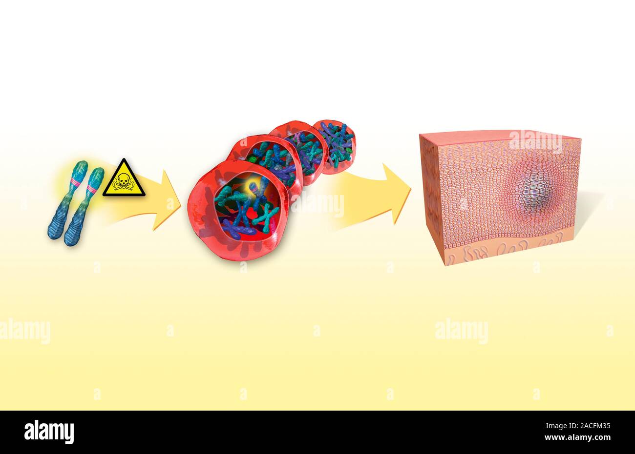 Genetic mutations and cancer. Artwork showing the genetic basis of the ...