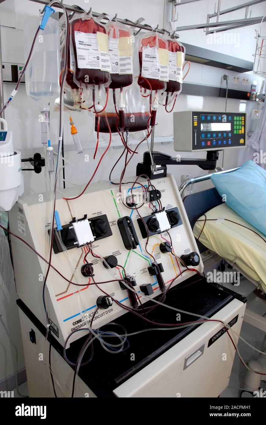 Apheresis machine. Apheresis is a procedure which consists of ...