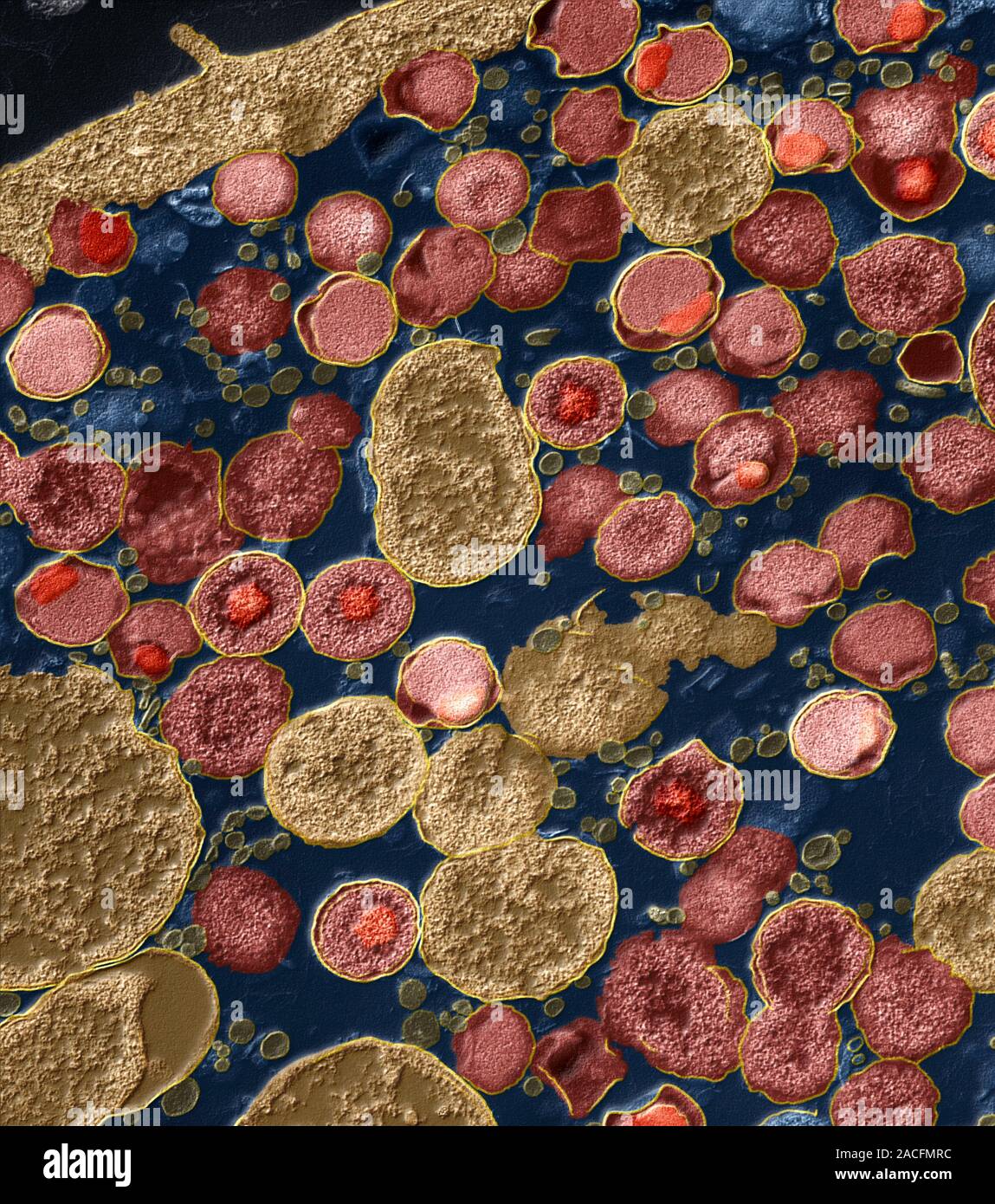 Chlamydia trachomatis bacteria, coloured transmission electron ...