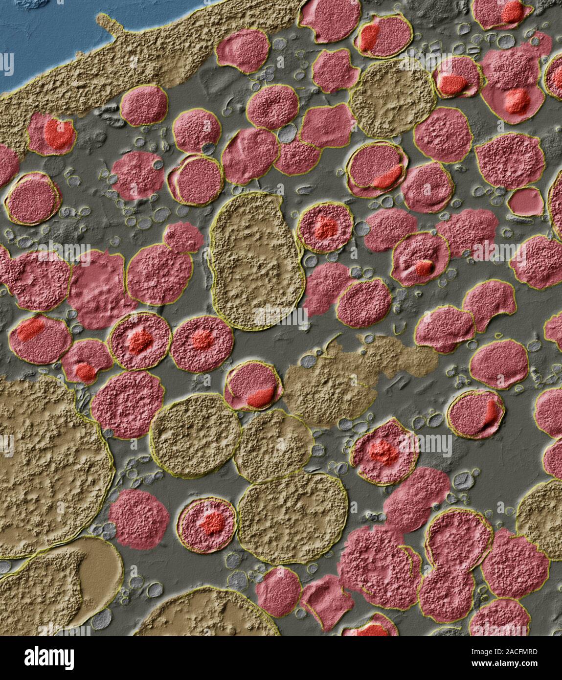 Chlamydia trachomatis bacteria, coloured transmission electron ...