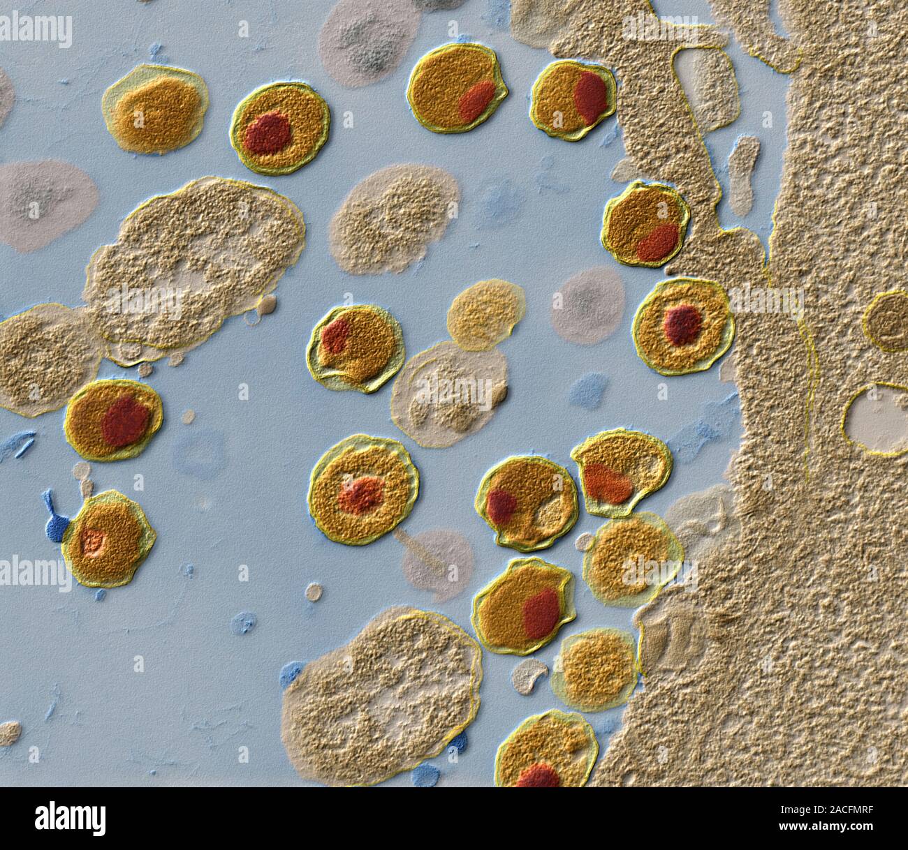Chlamydia trachomatis bacteria, coloured transmission electron ...