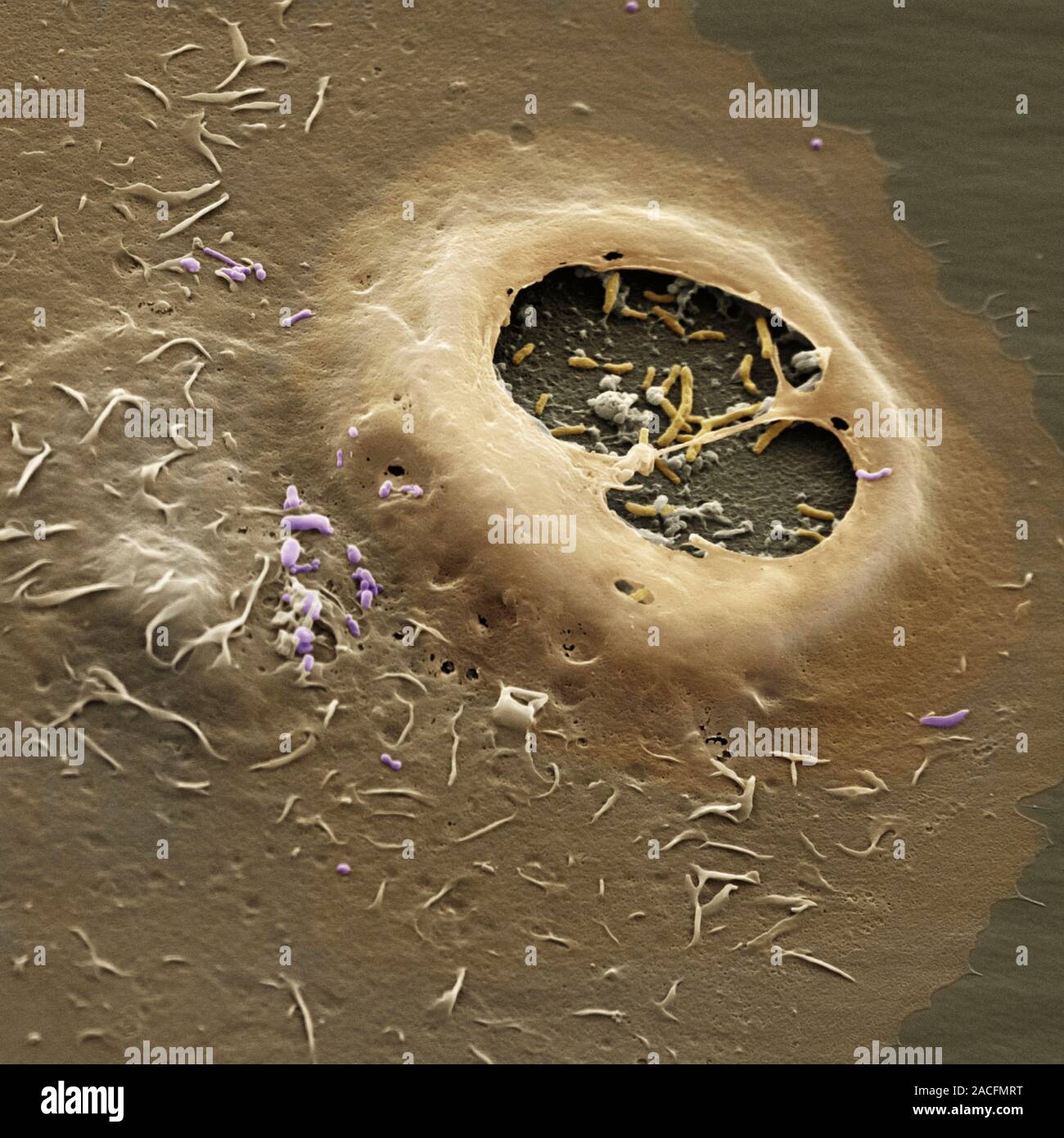 Q fever bacteria (Coxiella burnetii, yellow), coloured transmission ...