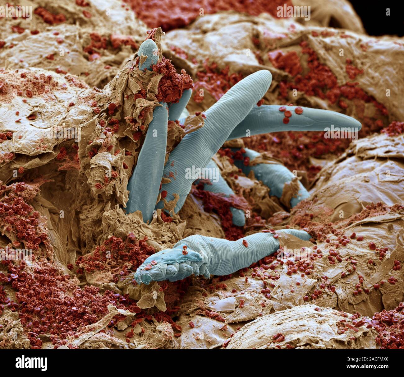 Eyelash mites in skin, coloured scanning electron micrograph (SEM ...