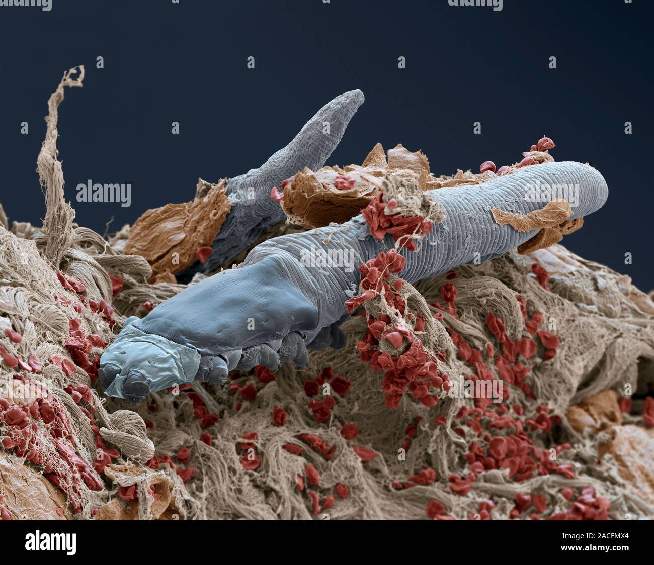 Eyelash mites in skin, coloured scanning electron micrograph (SEM ...