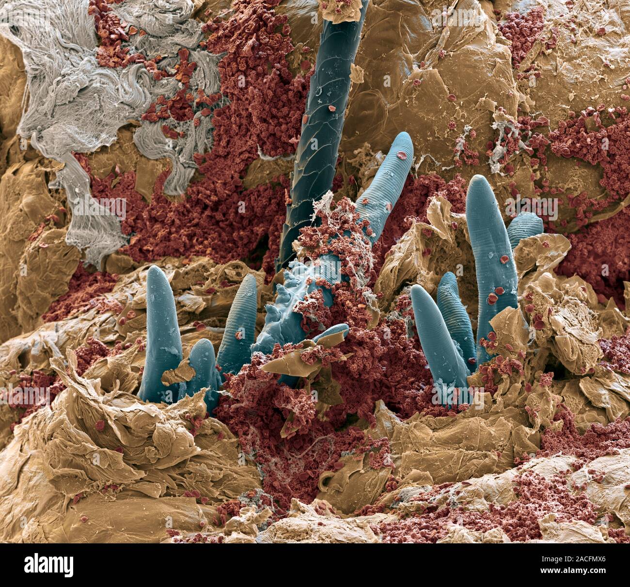 Eyelash mites in skin, coloured scanning electron micrograph (SEM ...