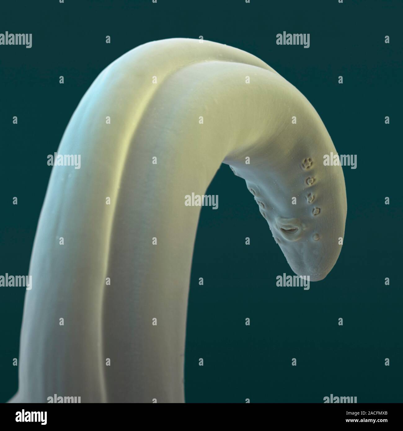 Heartworm. Coloured scanning electron micrograph (SEM) of the tail of a ...