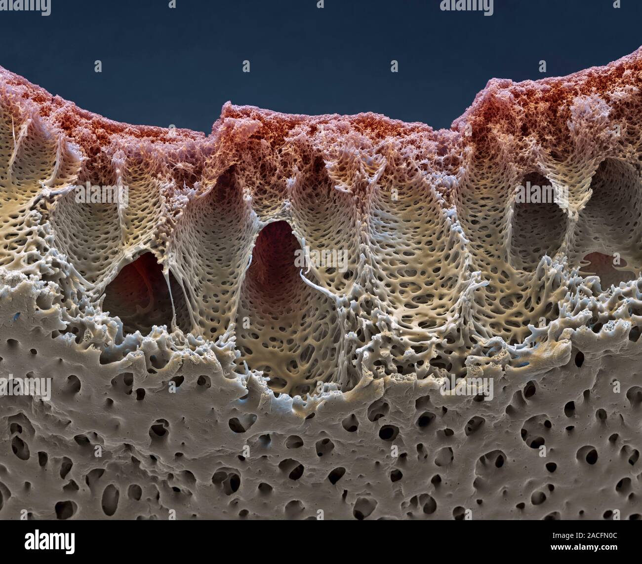 Kidney filtration tube. Coloured scanning electron micrograph (SEM) of ...