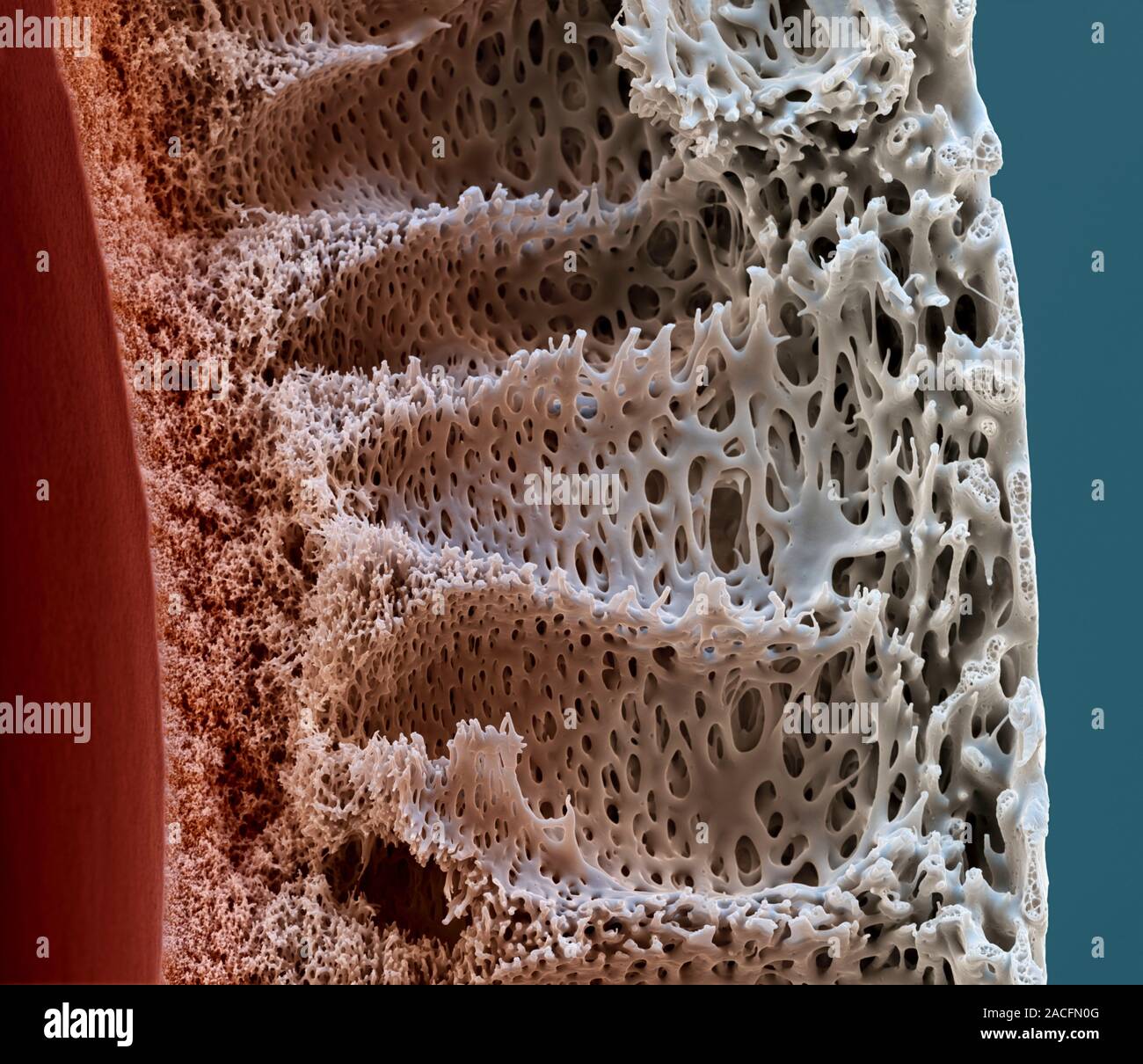 Kidney filtration tube. Coloured scanning electron micrograph (SEM) of ...