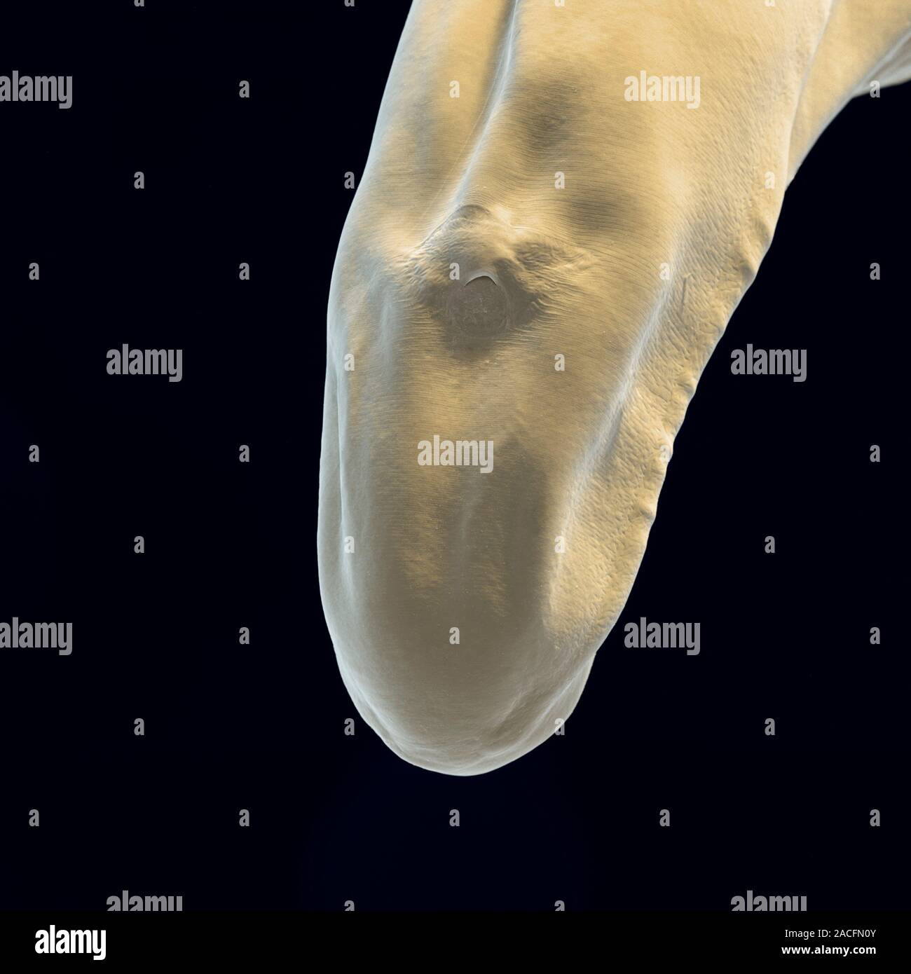 Heartworm. Coloured scanning electron micrograph (SEM) of the head of a ...