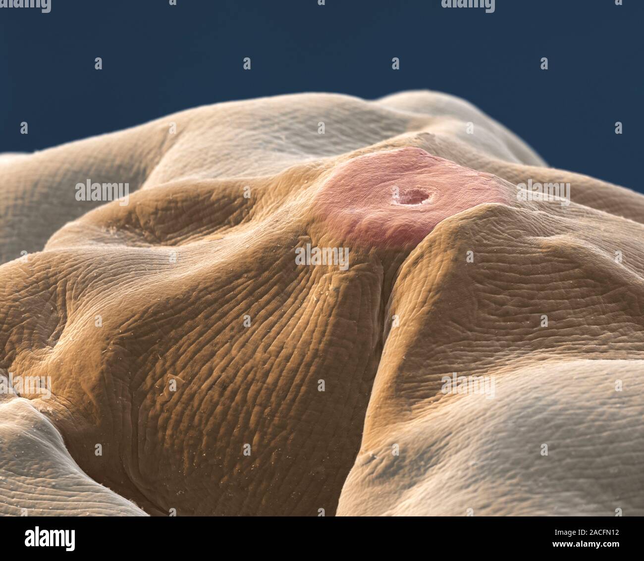 Heartworm. Coloured scanning electron micrograph (SEM) of the head of a ...