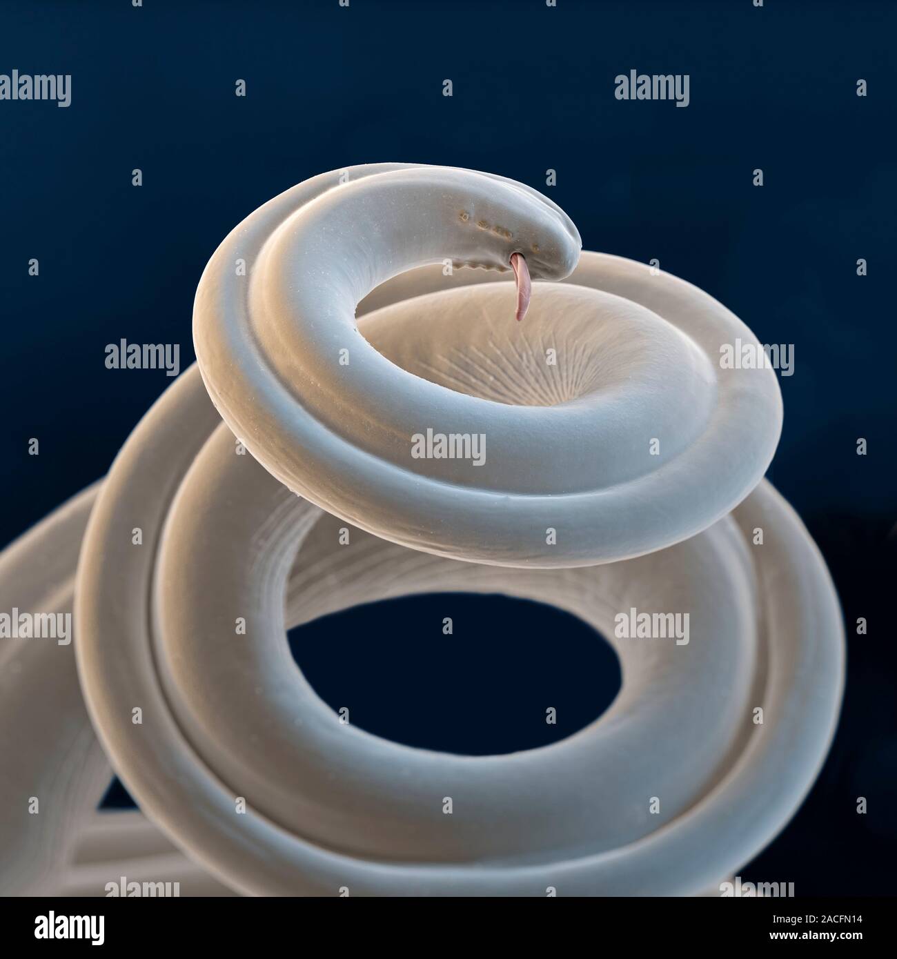 Heartworm. Coloured scanning electron micrograph (SEM) of the tail of a ...