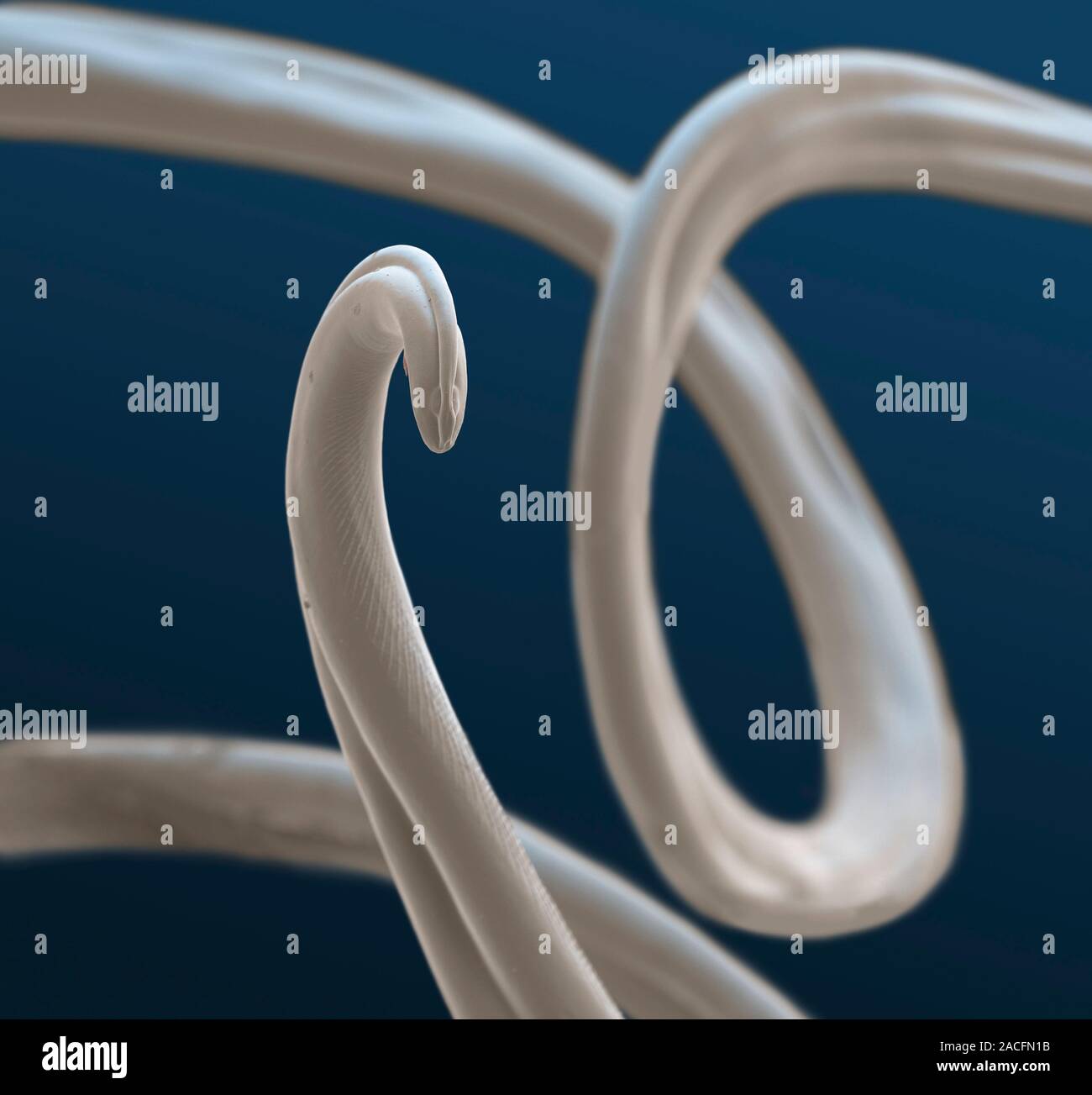 Heartworm. Coloured scanning electron micrograph (SEM) of the tail of a ...